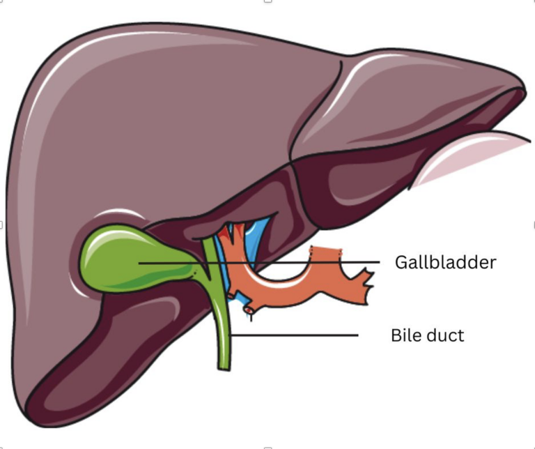 Gallstones 101: Understanding Gallstone Pain, Symptoms & Causes - Dr ...
